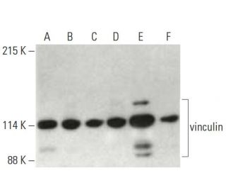vinculin Antibody (H-10) - Western Blotting - Image 396494