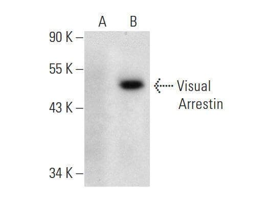 Anti-Visual Arrestin Antibody (A-3) | SCBT - Santa Cruz Biotechnology