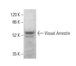 Anti-Visual Arrestin Antibody (A-3) | SCBT - Santa Cruz Biotechnology