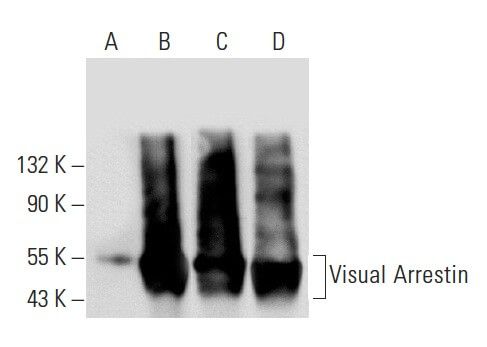 Visual Arrestin Antibody (B-2) | SCBT - Santa Cruz Biotechnology