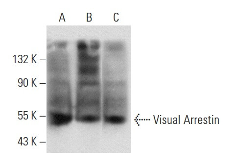 Anti-Visual Arrestin Antibody (B-2) | SCBT - Santa Cruz Biotechnology