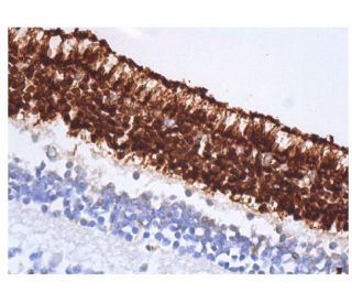 Visual Arrestin Antibody (C-1) | SCBT - Santa Cruz Biotechnology