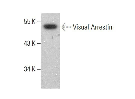 Visual Arrestin Antibody (F-2) | SCBT - Santa Cruz Biotechnology
