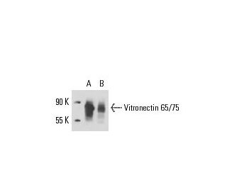 Vitronectin 65/75 Antibody (B-1) | SCBT - Santa Cruz Biotechnology