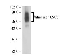 Vitronectin 65/75 Antibody (B-1) | SCBT - Santa Cruz Biotechnology