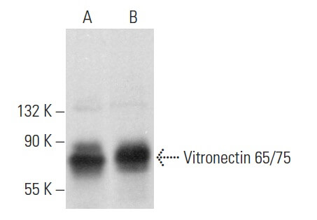 Vitronectin 65/75 Antibody (B-1) | SCBT - Santa Cruz Biotechnology