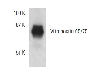 Vitronectin 65/75 Antibody (D-8) | SCBT - Santa Cruz Biotechnology