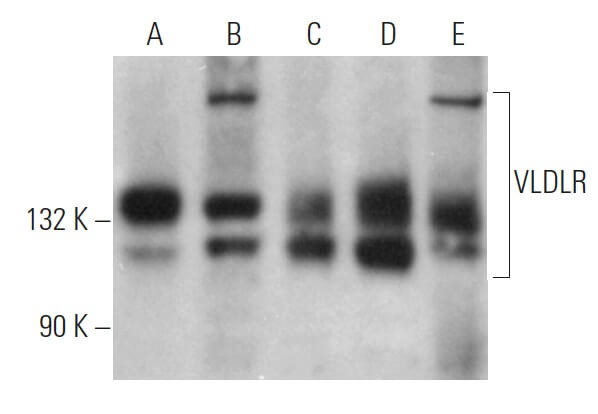 Anti-VLDLR Antibody (E-8) | SCBT - Santa Cruz Biotechnology