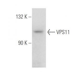 VPS11 Antibody (S-38) | SCBT - Santa Cruz Biotechnology