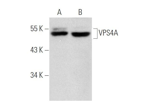 VPS4A抗体 (A-11) | SCBT - Santa Cruz Biotechnology