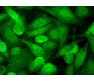 VPS4A Antibody (A-11) | SCBT - Santa Cruz Biotechnology