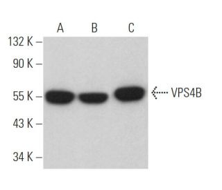 VPS4B抗体 (A-11) | SCBT - Santa Cruz Biotechnology
