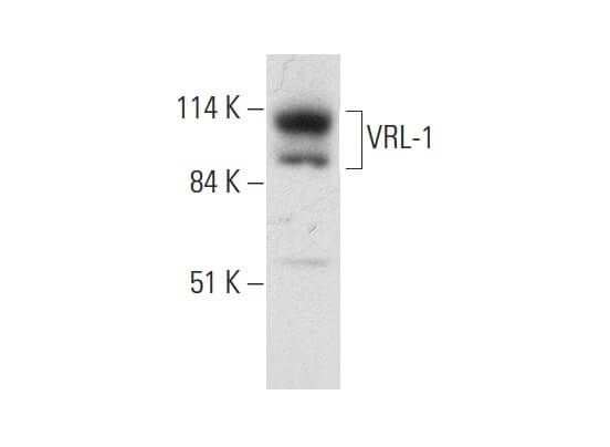 VRL-1 Antibody (B-9) | SCBT - Santa Cruz Biotechnology