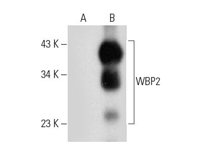 WBP2 Antibody (D-12) | SCBT - Santa Cruz Biotechnology