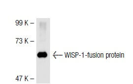WISP-1 Antibody (A-9) | SCBT - Santa Cruz Biotechnology