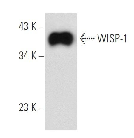 WISP-1 Antibody (C-2) | SCBT - Santa Cruz Biotechnology