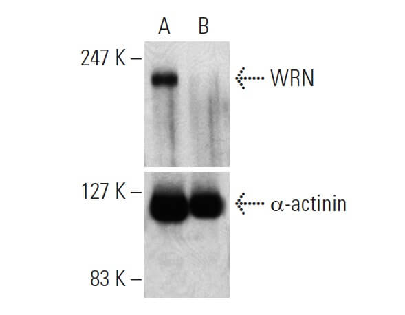 WRN siRNA (h), shRNA and Lentiviral Particle Gene Silencers | SCBT ...
