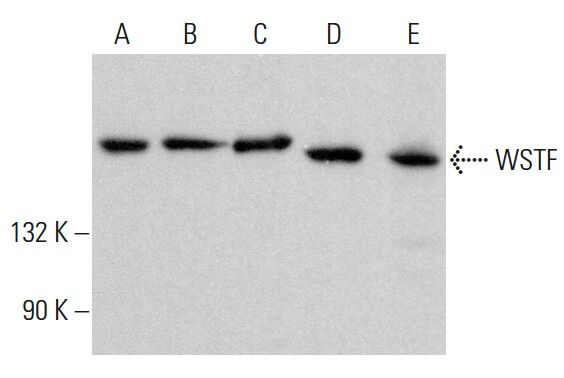 WSTF抗体 (G-5) | SCBT - Santa Cruz Biotechnology