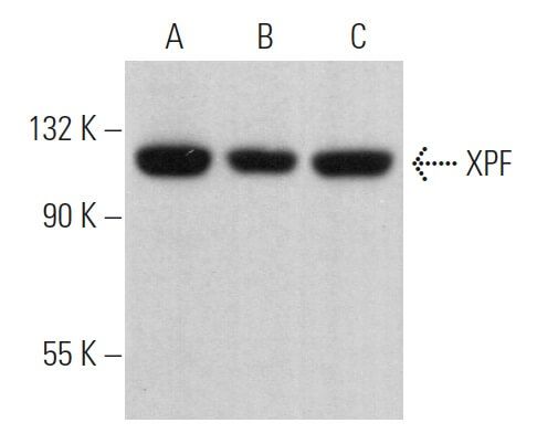 XPF Antibody (3F2/3) | SCBT - Santa Cruz Biotechnology