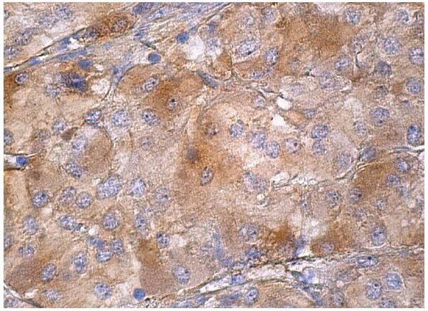 YSK1 Antibody (E-5) | SCBT - Santa Cruz Biotechnology