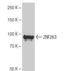 ZNF263 Antibody (8-YD33) | SCBT - Santa Cruz Biotechnology