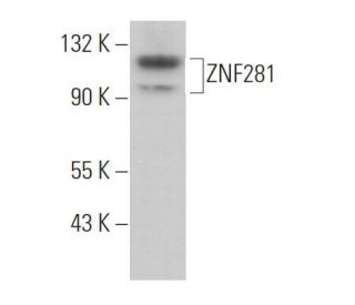 Anti-ZNF281 Antibody (G-9) | SCBT - Santa Cruz Biotechnology