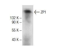 ZP1 Antibody (D-4) | SCBT - Santa Cruz Biotechnology