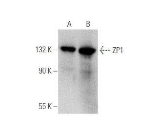 ZP1 Antibody (D-4) | SCBT - Santa Cruz Biotechnology