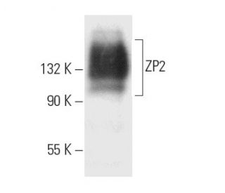 ZP2 Antibody (IE-3) | SCBT - Santa Cruz Biotechnology