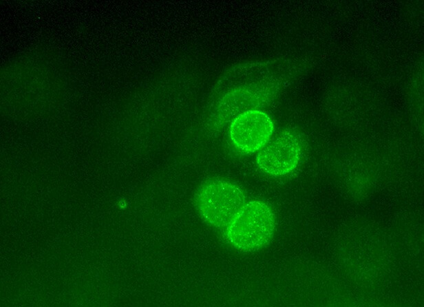 Anti-ZP3 Antibody (G-1) | SCBT - Santa Cruz Biotechnology