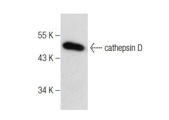 ZR-75-1 Cell Lysate | SCBT - Santa Cruz Biotechnology